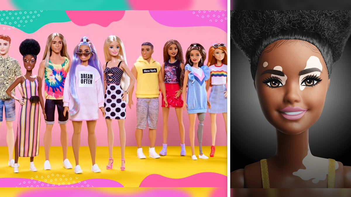 Lanzan Barbie con vitiligo y otras “fashionistas” en pro de la ...