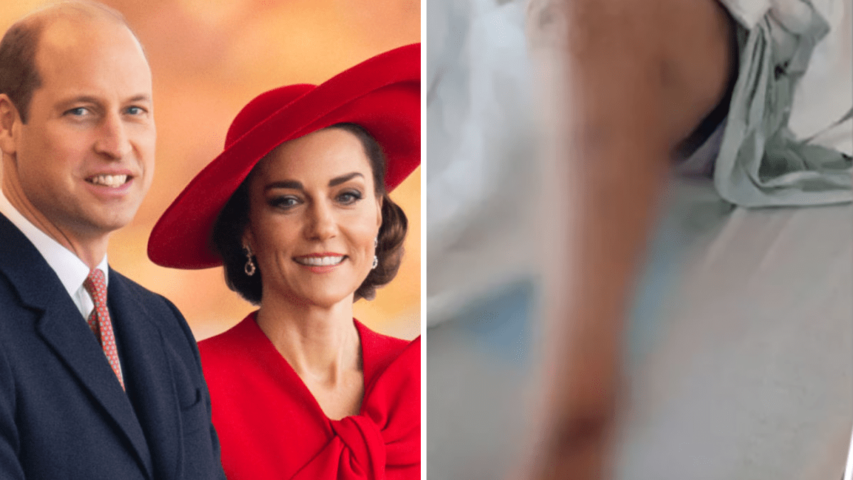 La disculpa de Kate Middleton y otras noticias insólitas – Telemundo ...