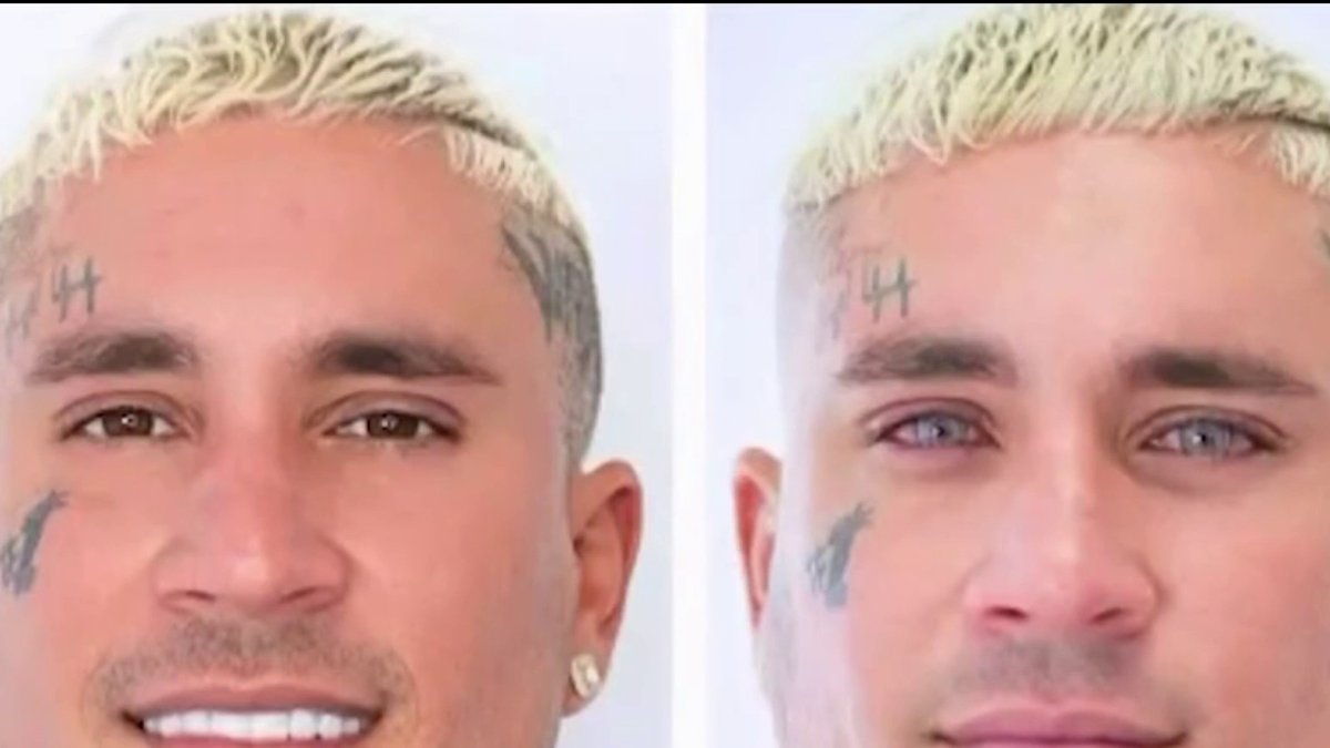 Cambio de color de ojos: la nueva y costosa tendencia estética ...